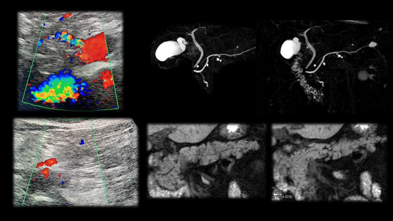専門医による東京目白クリニックの膵臓がんドック -膵臓がんリスク因子を知る-
